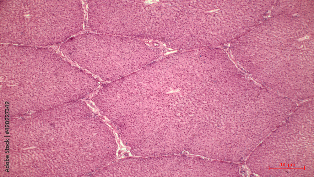 Liver Tissue Under Microscope. Hepatocytes cells form radial sheets, or ...