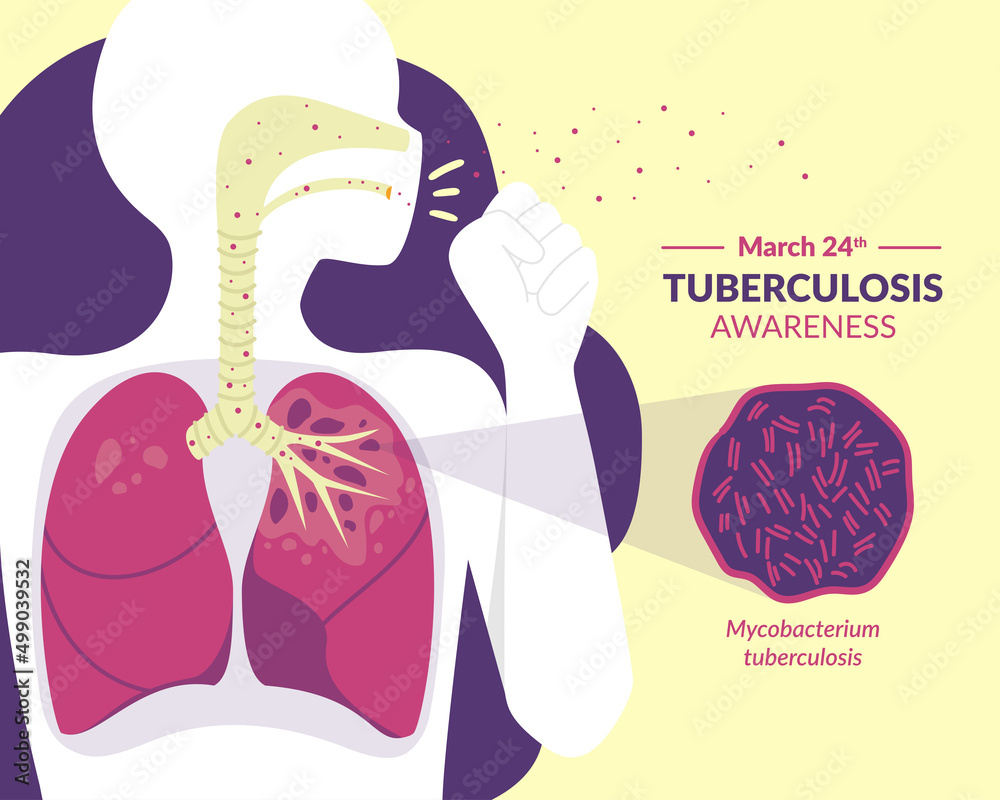 Tuberculosis awareness day, poster of the lungs that infected with ...