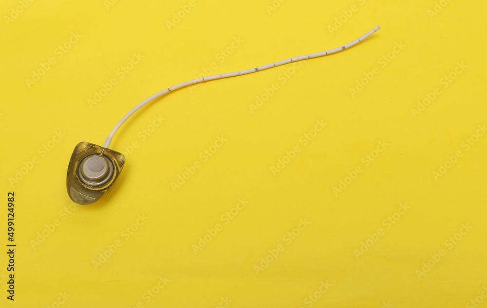 A chemo port catheter .It is used to give intravenous fluids, blood ...