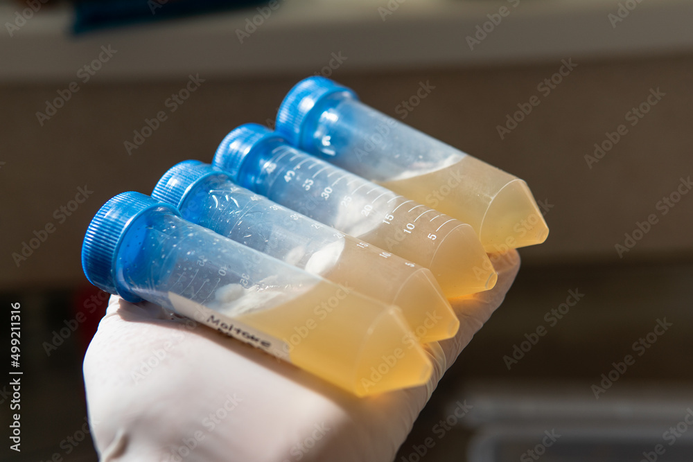 .centrifuge tube with a nutrient medium for the development of mycelium ...