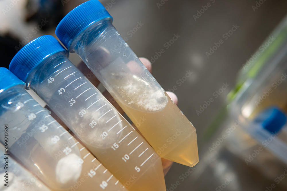 .centrifuge tube with a nutrient medium for the development of mycelium ...