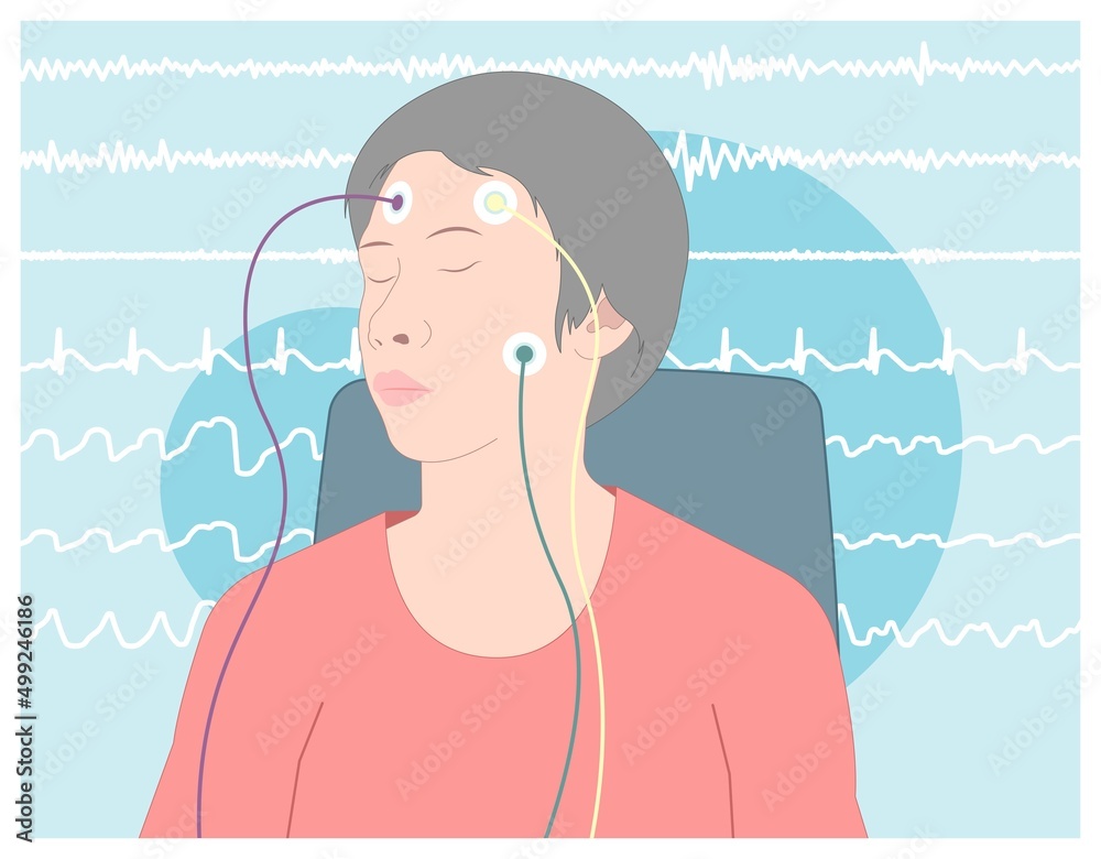 Stockvector Insomnia Sleep therapies treat ADHD brain wave feedback ...