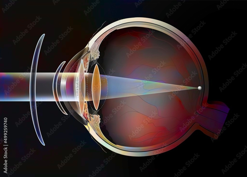 Different possible corrections of a presbyopic eye: spectacle lenses ...