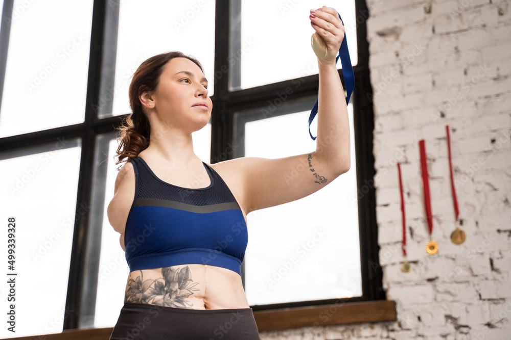 Female with amputee hand holding her medal and looking on it Stock ...