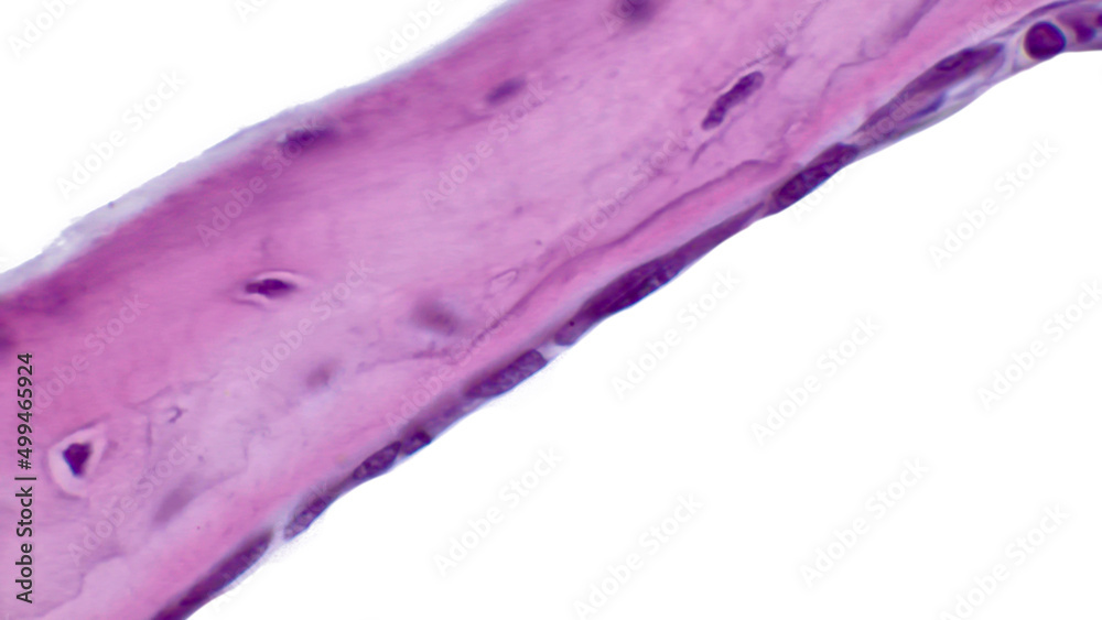 Light micrograph of intramembranous ossification. Trabeculae of bone ...
