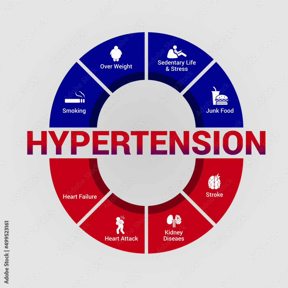 Causes of Hypertension vector infographic Stock Vector | Adobe Stock