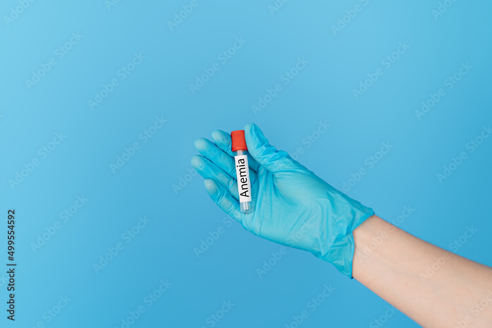 Hand holding test tube with the inscription anemia. Stock Photo | Adobe ...