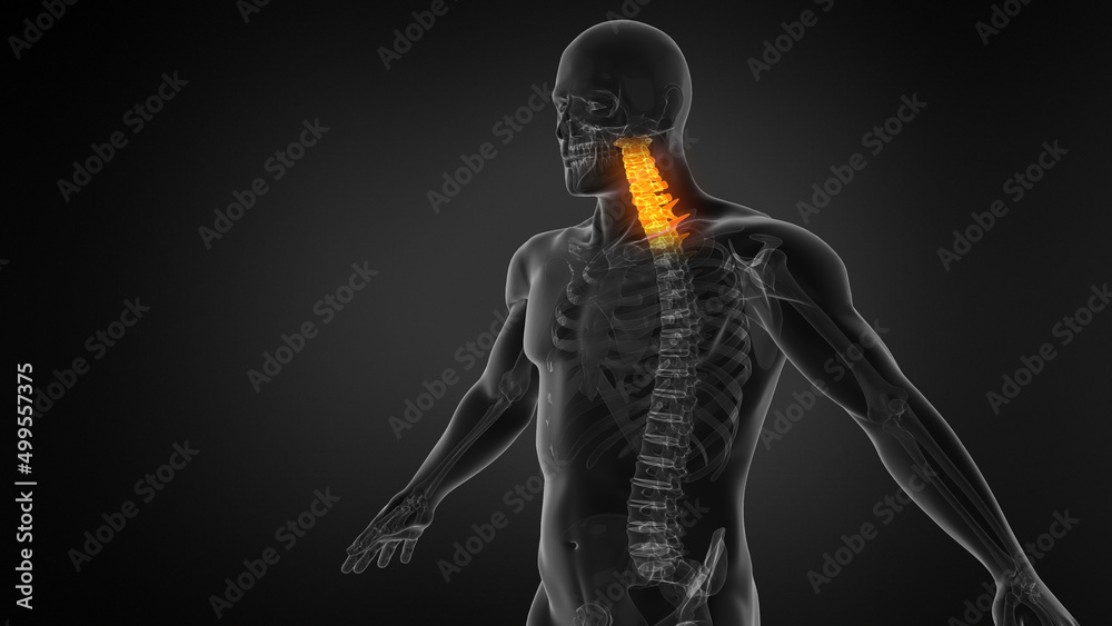 Anatomy of Human Spine. Neck pain. Stock Illustration | Adobe Stock