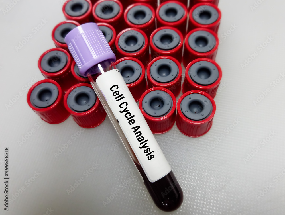 Blood sample for S Phase(cell Cycle Analysis) test, quantitative Flow ...