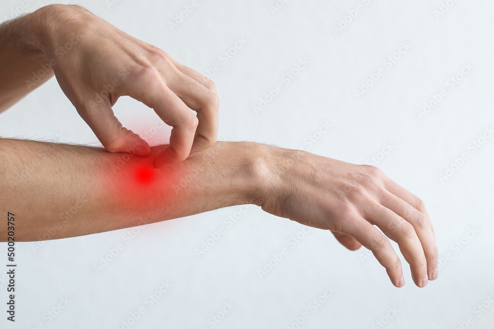 the man injured his wrist. He suffered a tendon injury, arthritis in ...