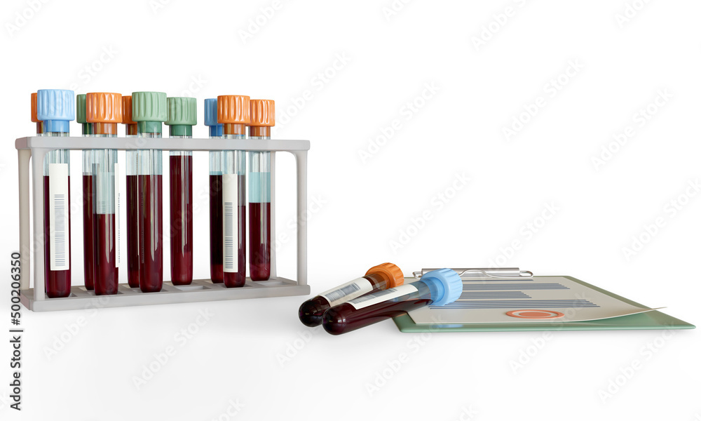 3d laboratory test tubes with blood tests in a rack. On table checklist ...