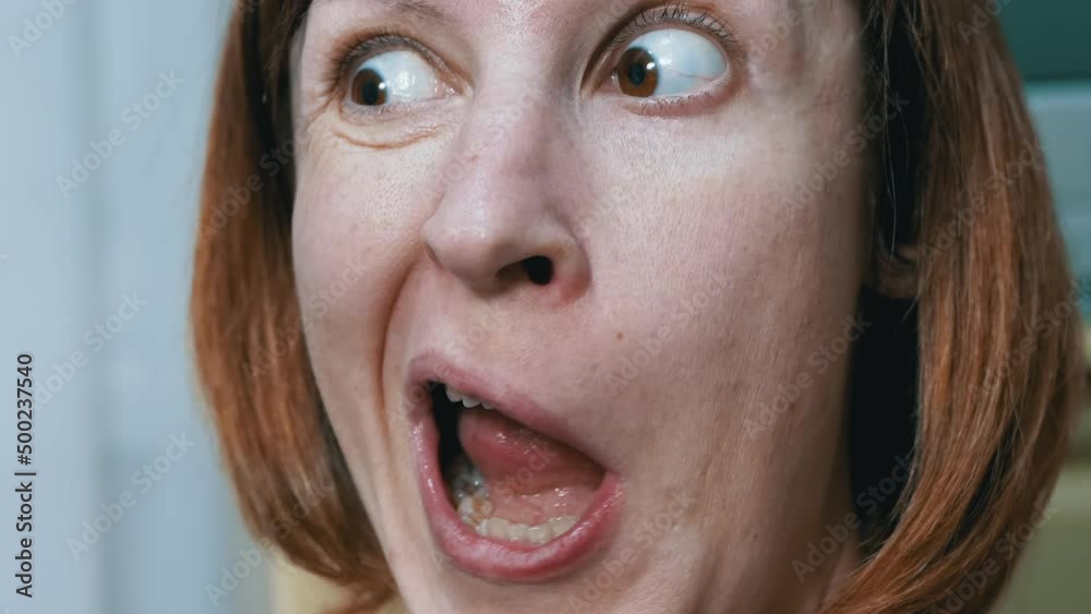 Close-up Facial Expressions of a Crazy Woman with Bulging Eyes, Crooked ...