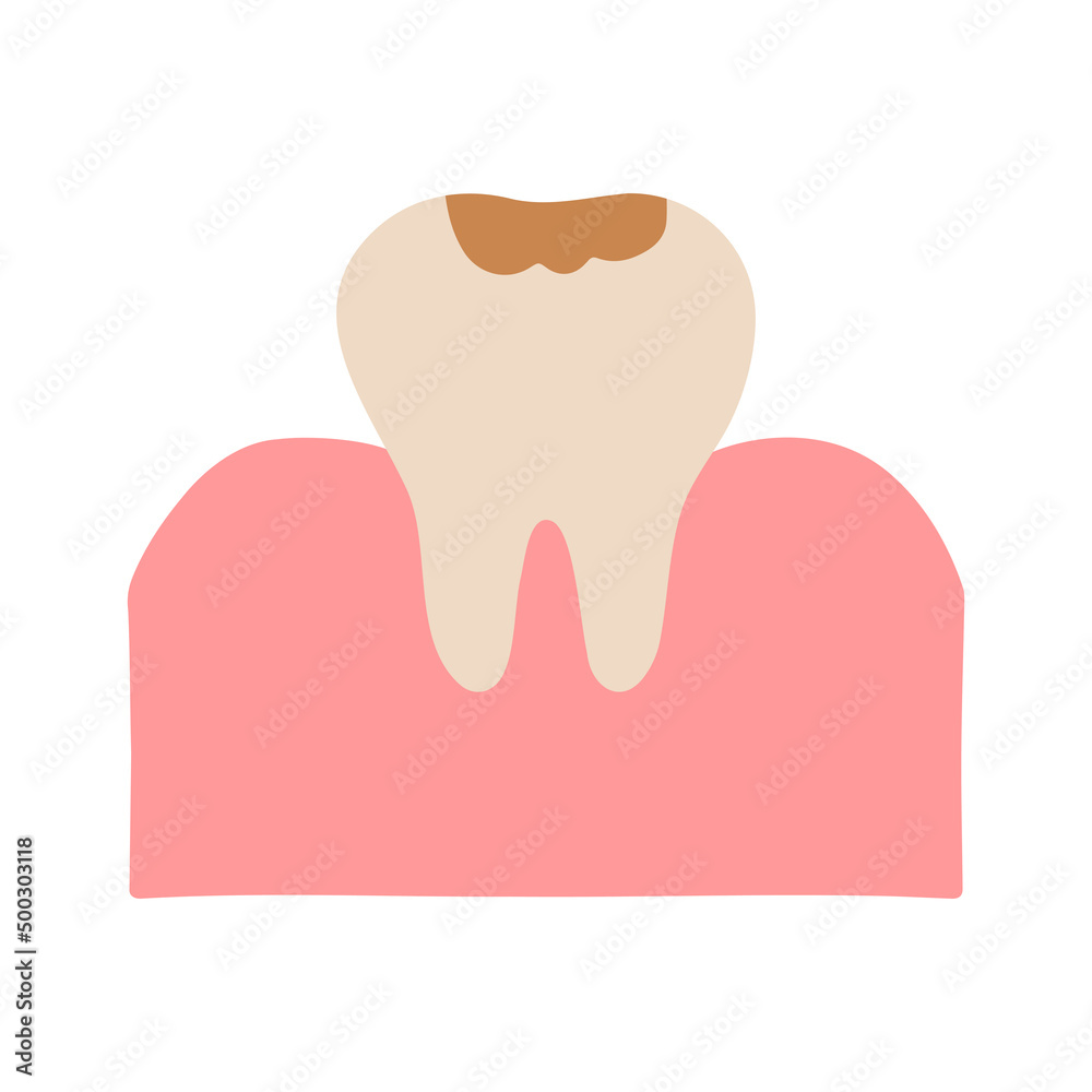 Cute cartoon tooth Feel bad. dental caries, toothache, bad teeth ...