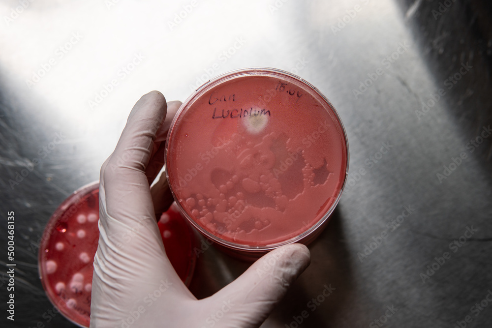 mold and bacteria on red agar. Agar medium for pathogens. Mold spores ...