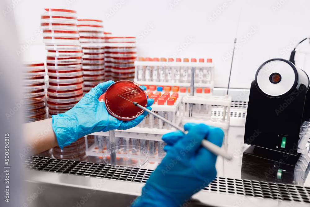 Hand of medical worker on agar plate culture bacteria, resistance ...