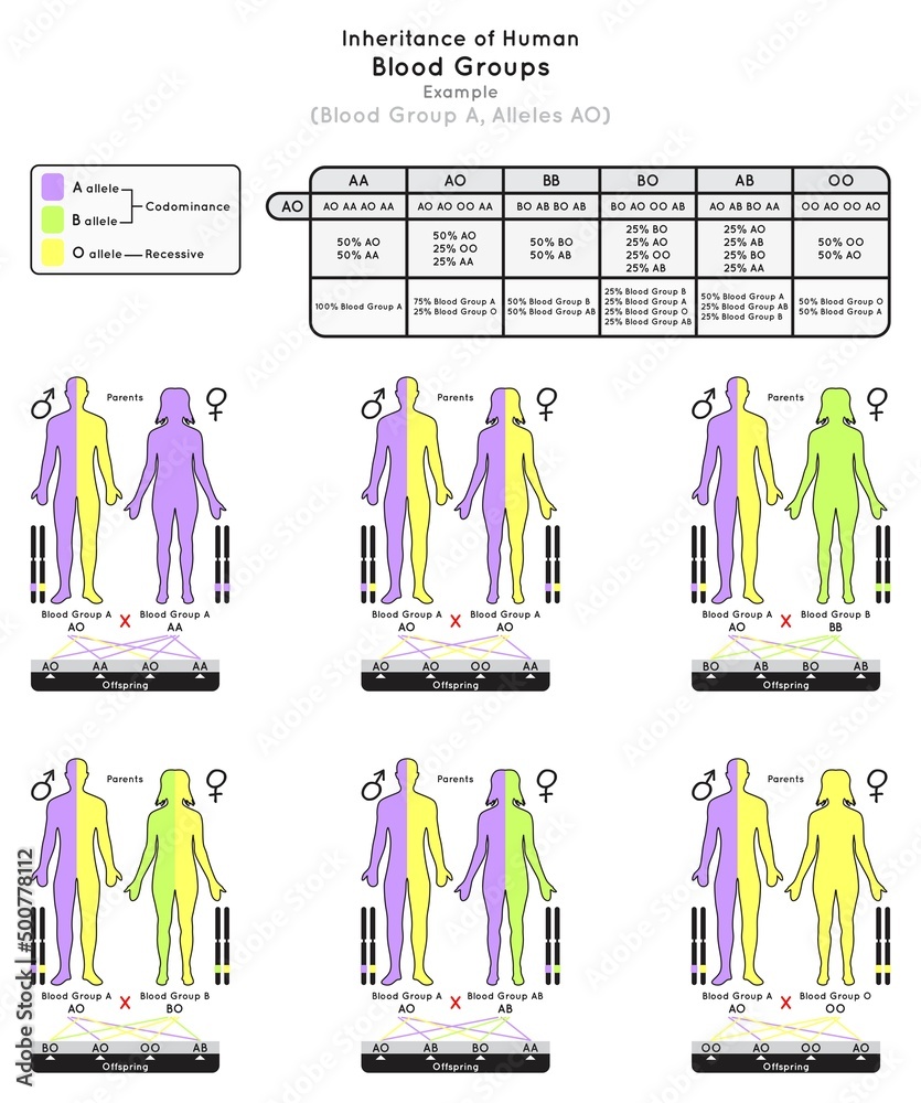 Inheritance of Human Blood Group A Infographic Diagram example alleles ...