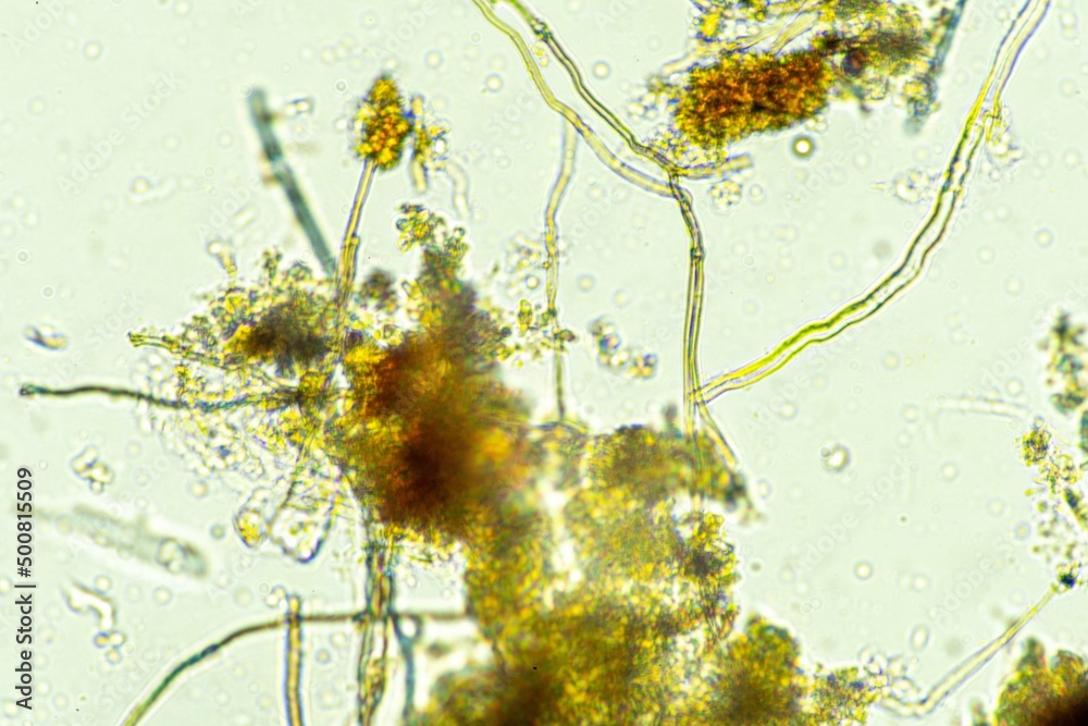 biological organisms under the microscopes in australia. living ...