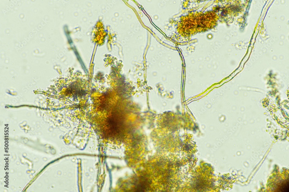 biological organisms under the microscopes in australia. living ...
