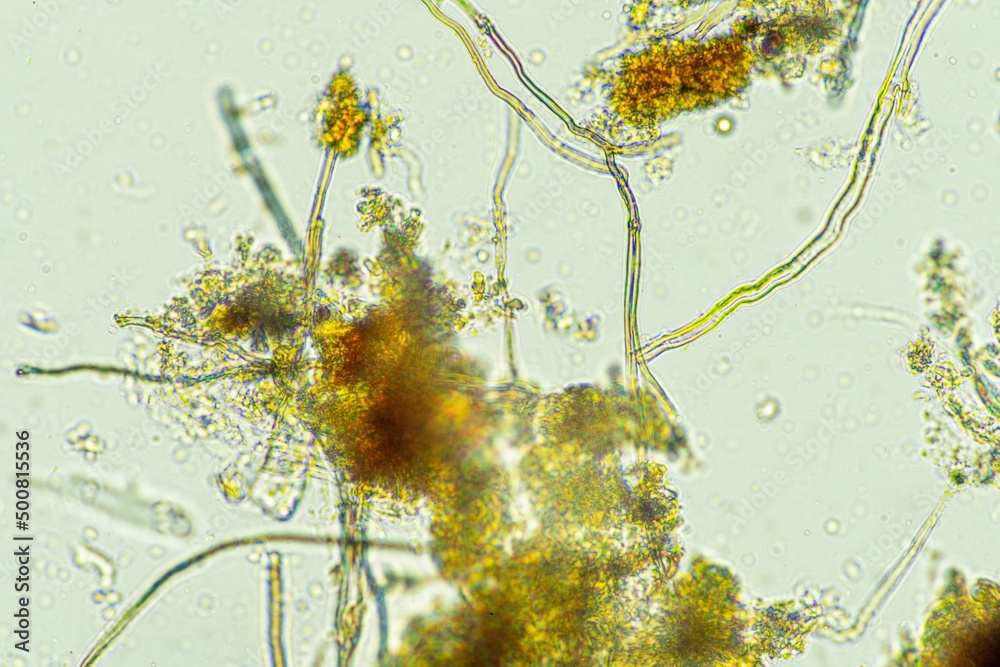 biological organisms under the microscopes in australia. living ... biological organisms under the microscopes in australia. living ...