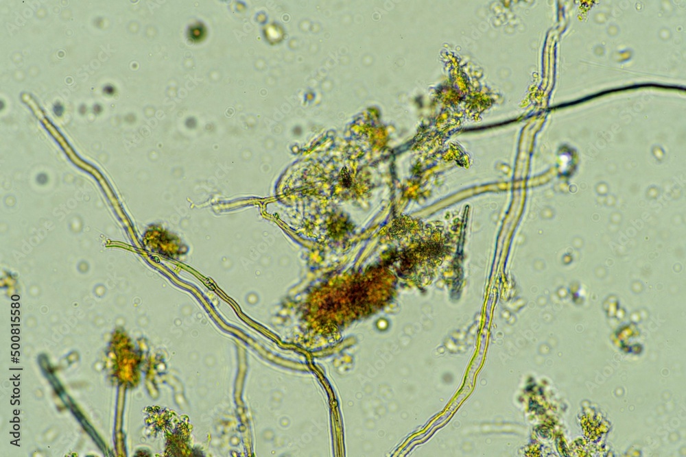 biological organisms under the microscopes in australia. living ...