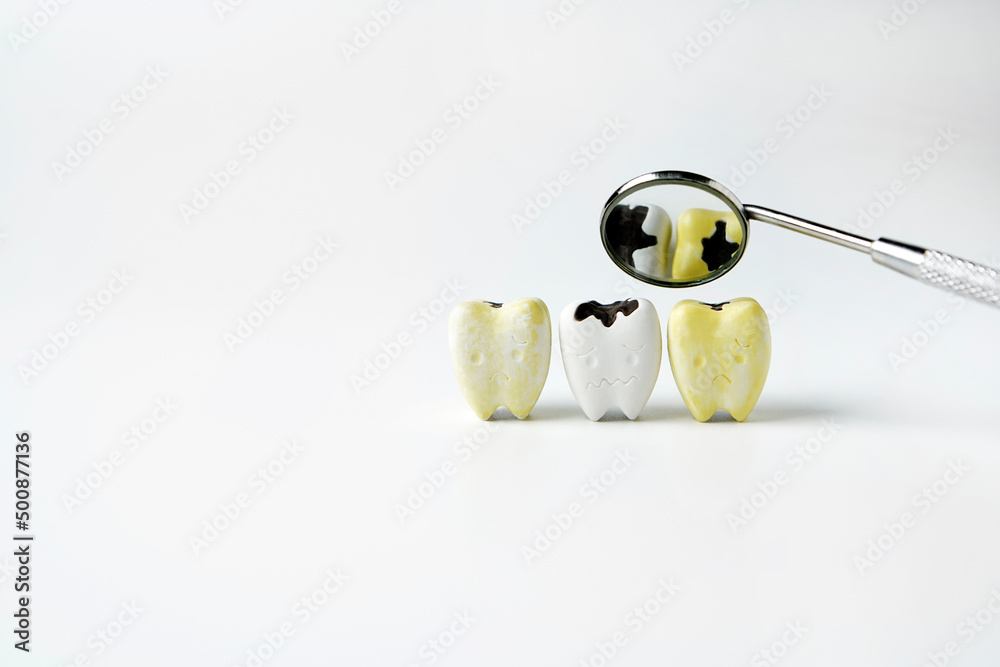 Decay and yellow tooth with black cavity and plaque reflect on mirror ...