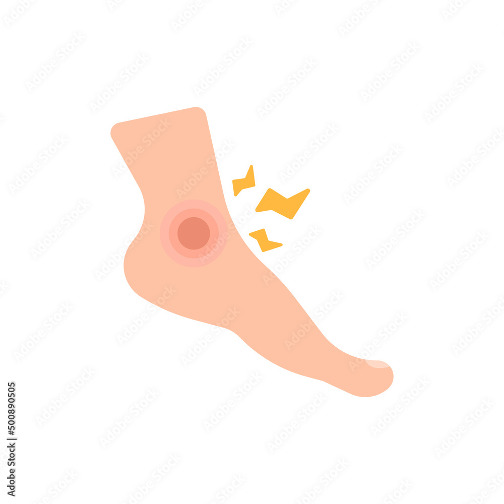 pain in the ankles. disease, injury, joint pain. health problems. flat ...