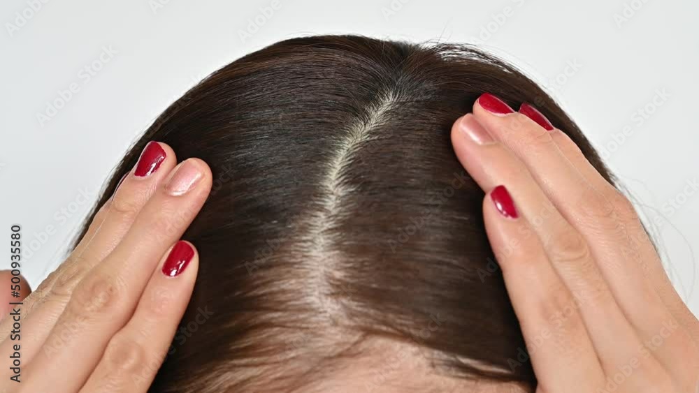 Close up of Asian woman worrying about her scalp with part of her thin ...