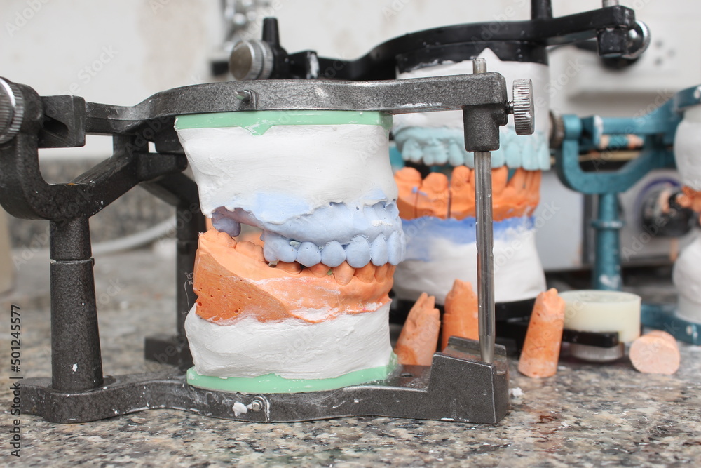 It is a procedure for making a dental model. before submitting the work ...