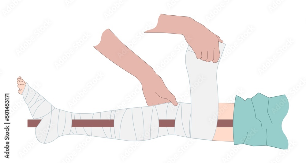 Snake Bite First Aid care non venomous anti venom serum hand leg king ...