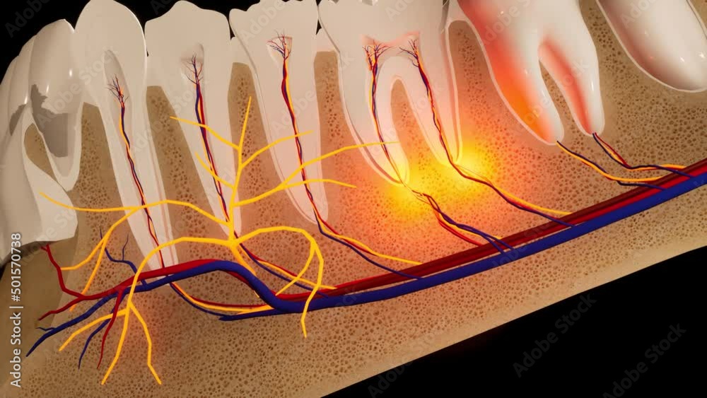 Toothache. Anatomical detailed section of the teeth. Nerve inflammation ...
