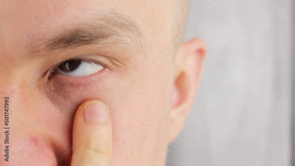 Pull the eyelid down.Diagnosis of vision.Check vision.Male eye ...