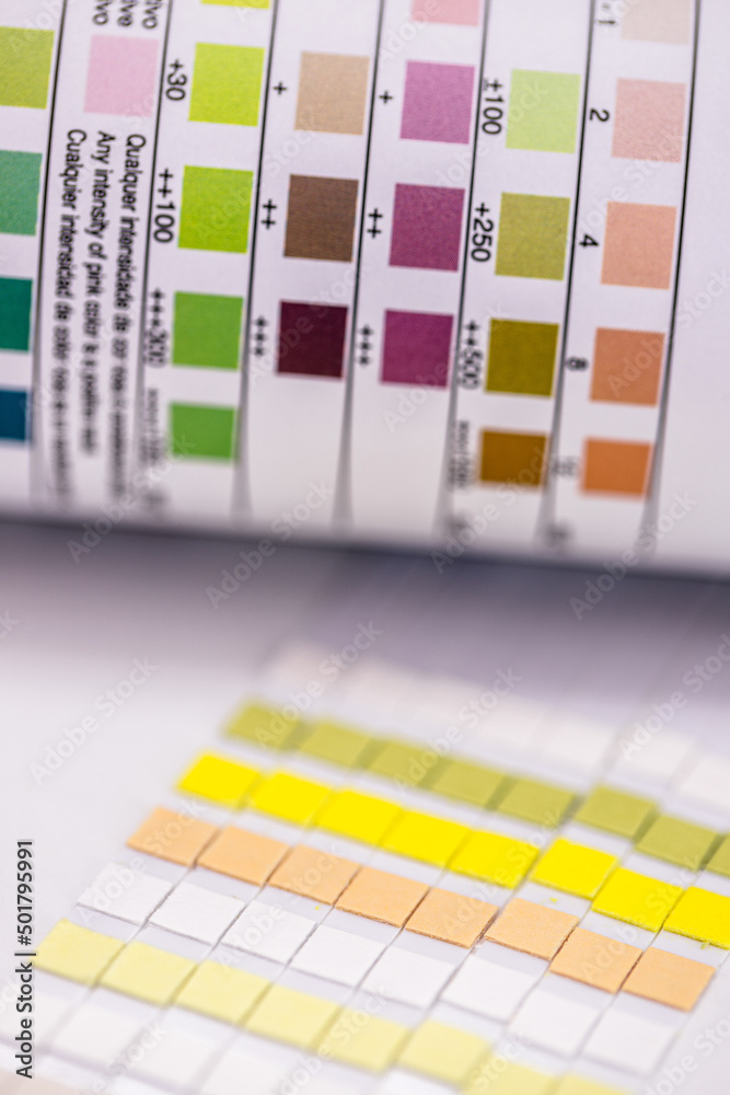 Urinalysis reagent strip used to control ketosis and other 9 parameters ...
