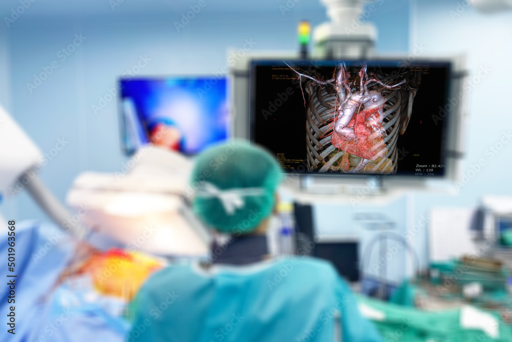 Blurry Close Up heart surgeon doctor operation heart surgery showing on ...