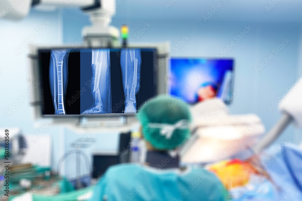 Blurry Close-Up Traumatology orthopedic surgery hospital emergency ...