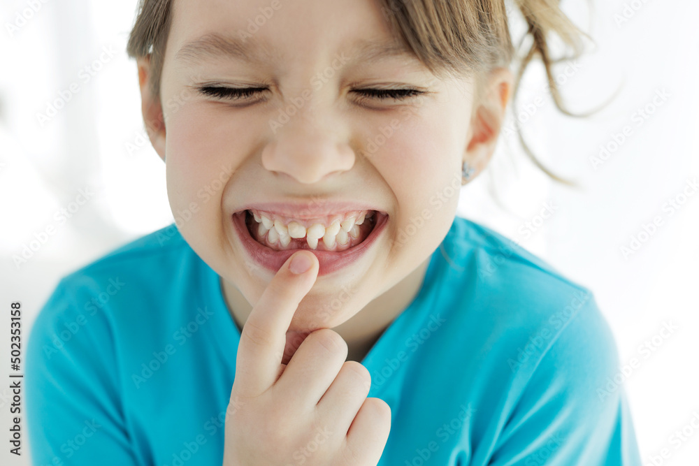 Foto de The kid lost a tooth. Baby without a tooth. Portrait of a ...