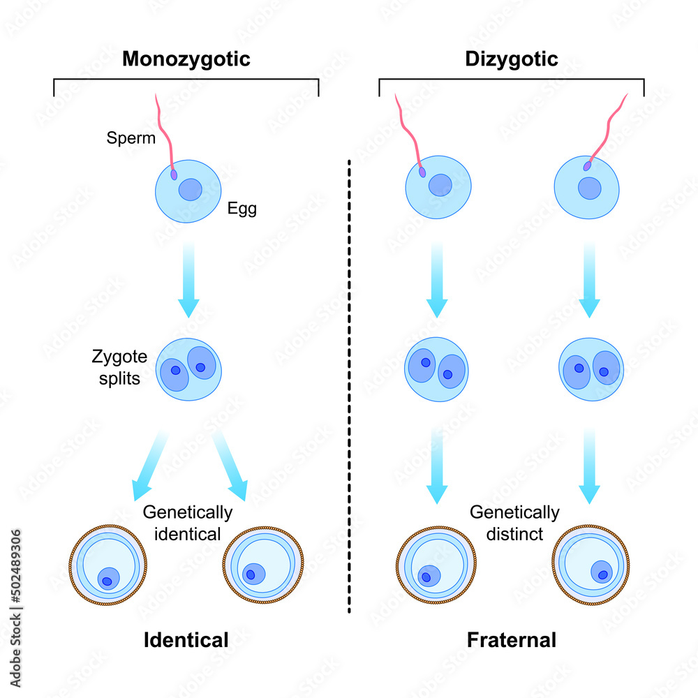 Scientific Designing of Differences Between Monozygotic And Dizygotic ... Scientific Designing of Differences Between Monozygotic And Dizygotic ...