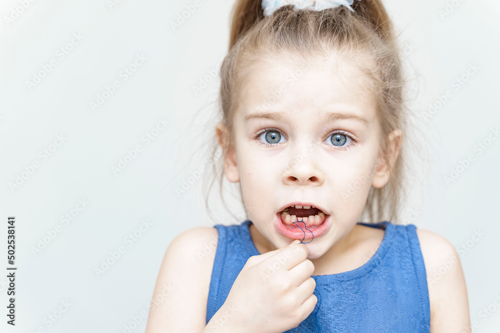 A 5 year old girl has a loose milk tooth. the baby tied the tooth with ...