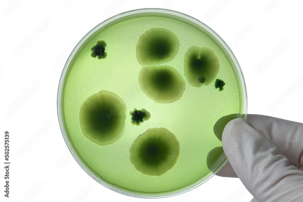 Hand with Petri dish or culture media with bacteria on white background ...