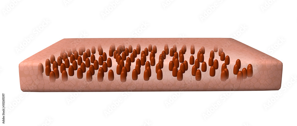 At a lower level of the epidermis are pigmentation cells called ...