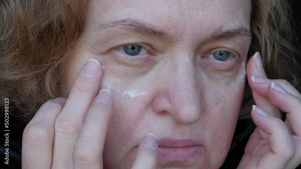 middle aged female's eye with drooping eyelid with patch for eyes ...