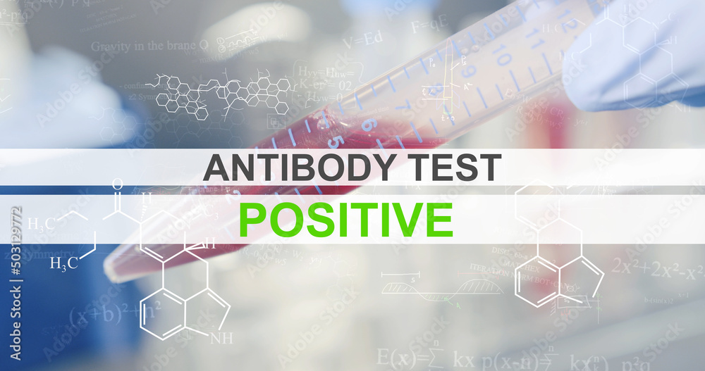 Positive antibody test poster- for covid testing Stock Photo | Adobe Stock