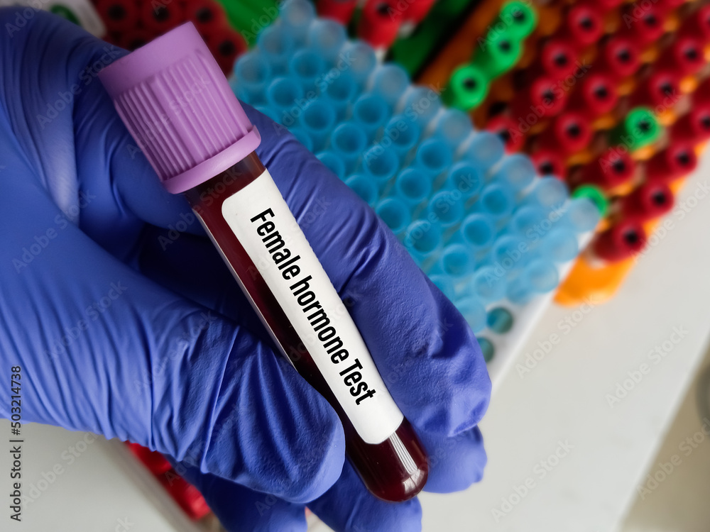 Blood sample for Female hormone test, focus view and laboratory ...