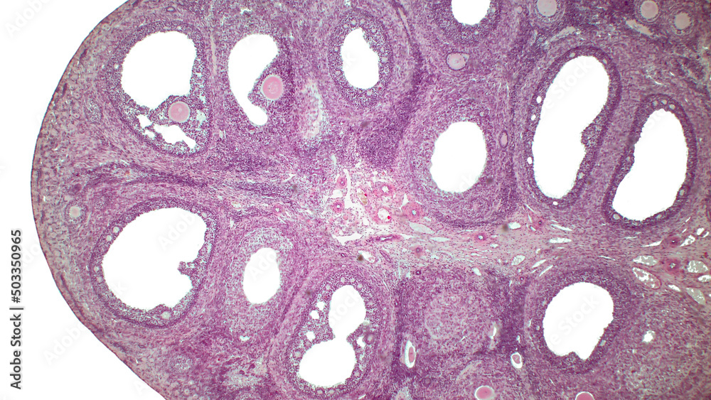 Light micrograph of the Cat's ovarian. Micrograph of ovary showing ...