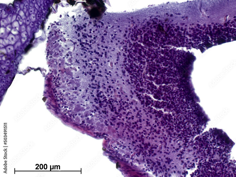 Sagittal section through olfactory bulbs. Hematoxylin and Eosin ...