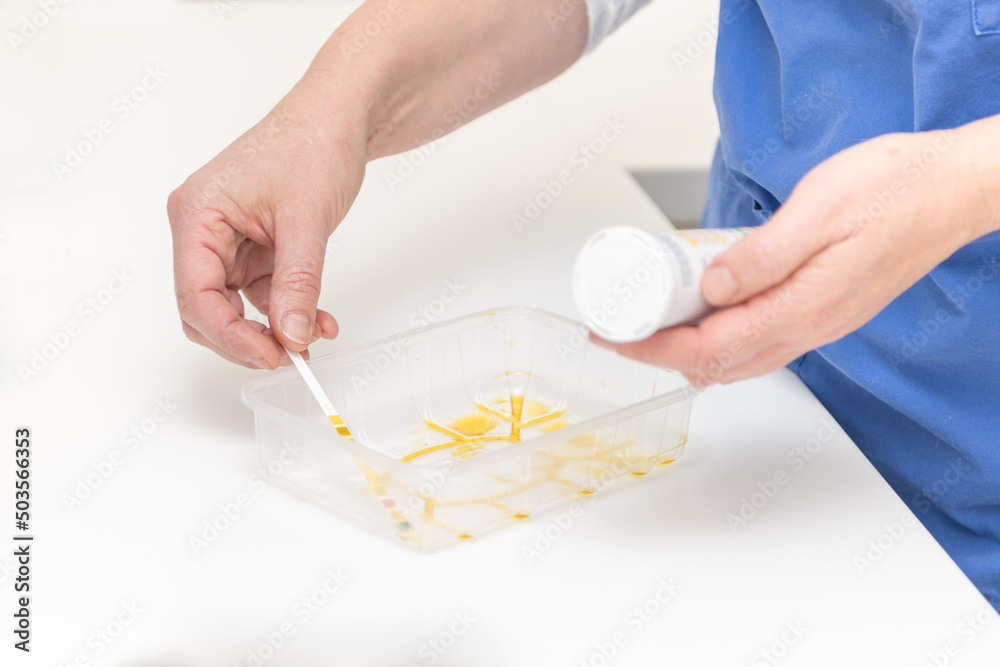 urine sample with test strip waiting for evaluation Stock Photo | Adobe ...