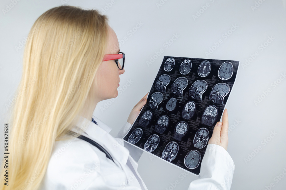 MRI of the brain. Neuropathologist holds a picture against the ...