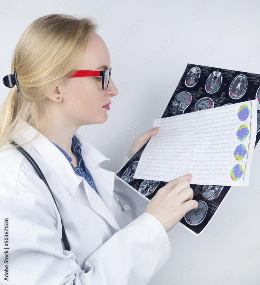 Epileptologist examines patient MRI and electroencephalogram. Concept ...
