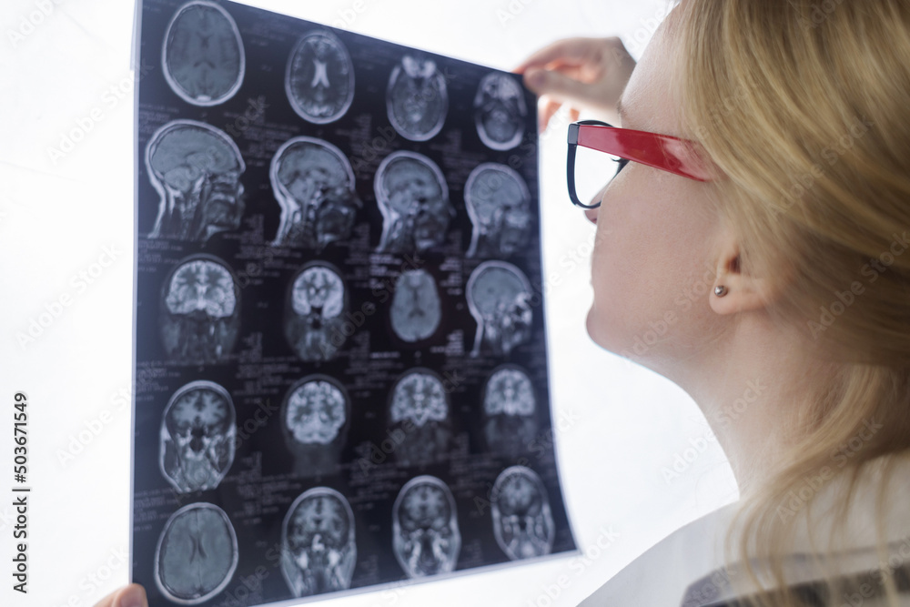 Epileptologist examines patient MRI and electroencephalogram. Concept ...