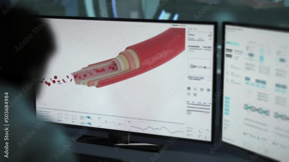 Doctor Scans Patients Vein By Modern Medical Software To Examine ...