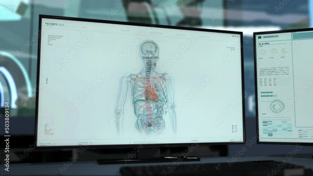 Anatomical examination system is checking the organ heath of the ...